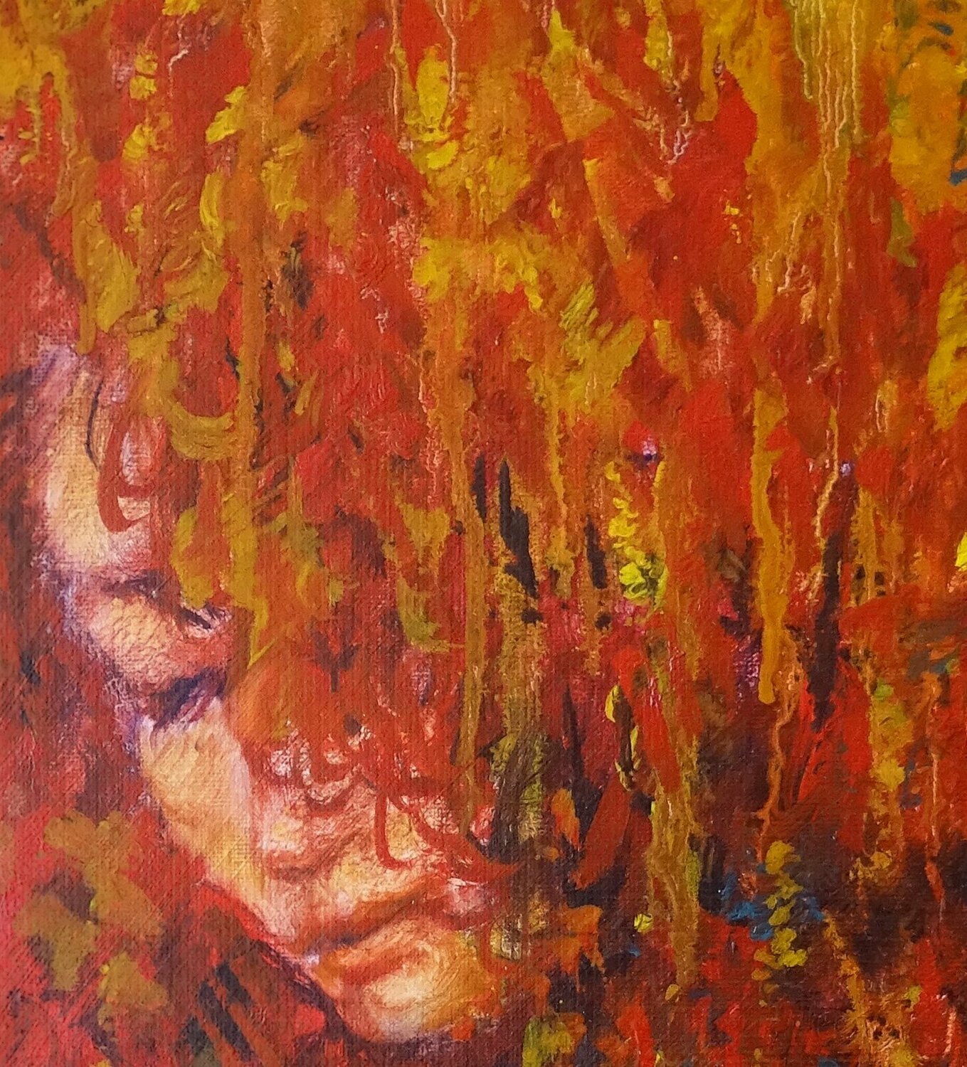 💜Ictus amnésique 💜Transient global amnesia 💜Transiente globale Amnesie ...