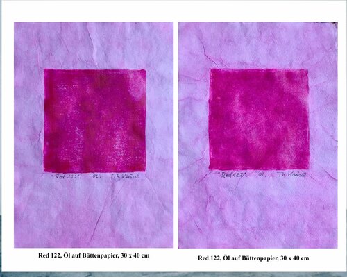 Serosanguinous Vs Sanguineous